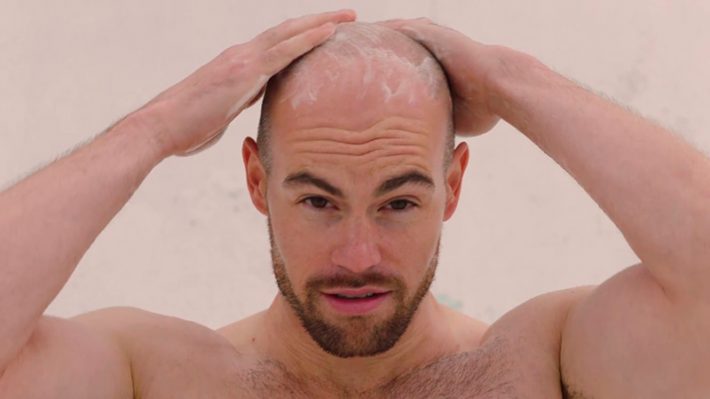 Careca masculina: 4 dicas de como cuidar da careca